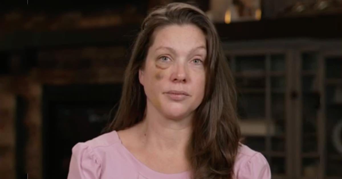 Cincinnati Beating Victim Speaks Out: 'This Was Attempted Murder ...